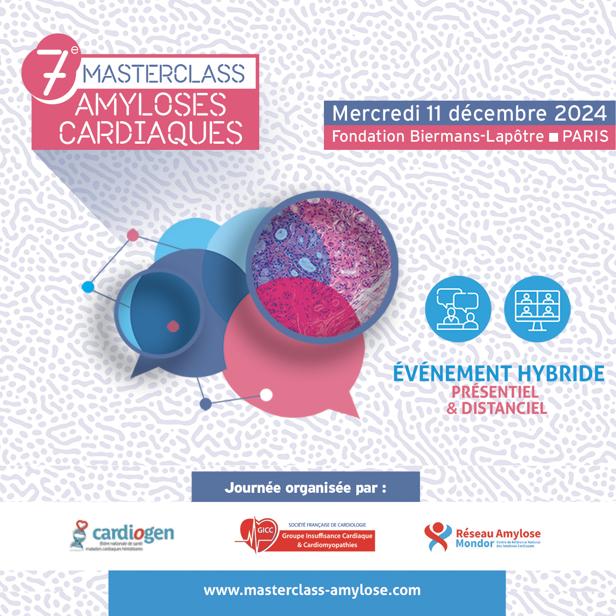 Réseau Amyloses Cardiaques - Centre de référence des amyloses cardiaques